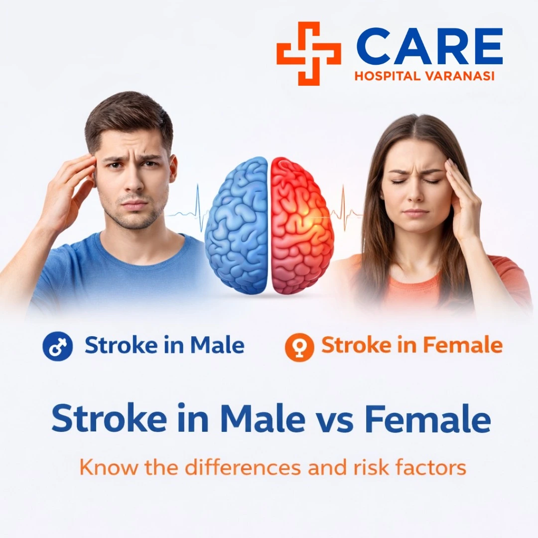 Stroke in Male vs Female : Hidden Risks & Symptoms You Miss