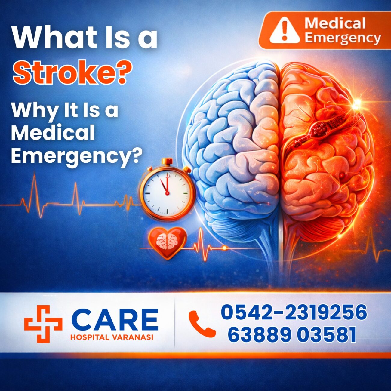 What Is Stroke? Causes, Symptoms, Types & Treatment